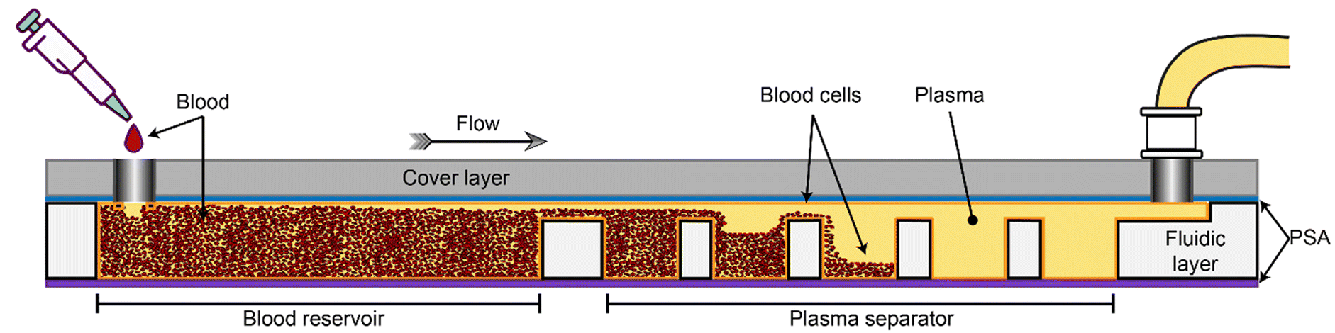 Microfluidic Device Simplifies Platelet-Rich Plasma Extraction - GizmoMD