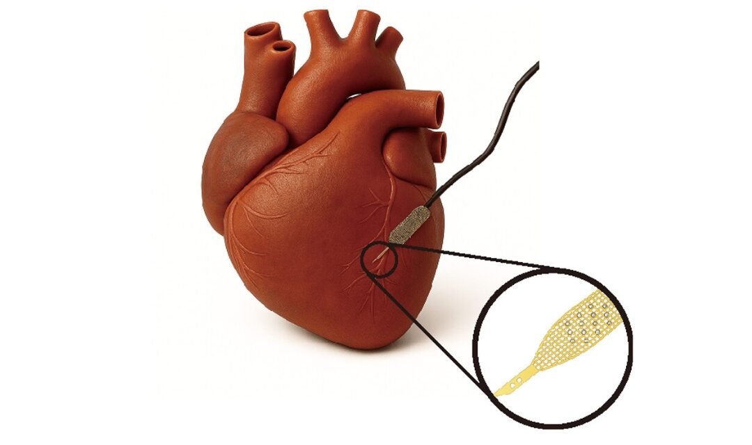 Smart Cardiac Patches Advance Stem Cell Repair Research - GizmoMD