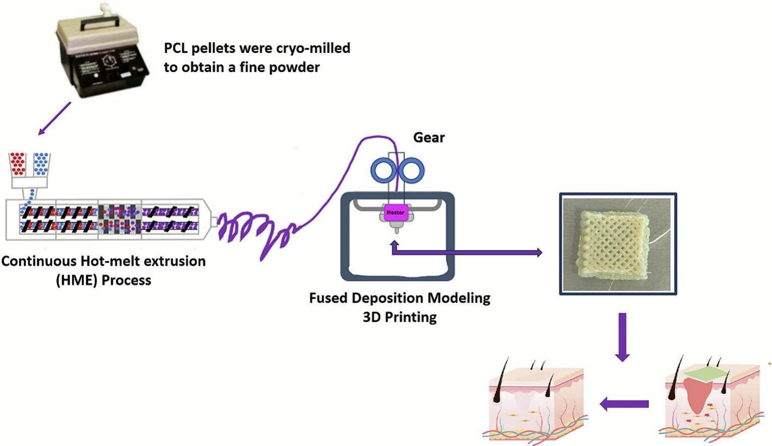 3D Printed Medicated Patch Designed to Support Healing in Chronic ...