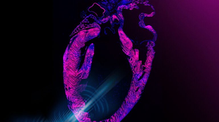 Ultrasound Pacemaker Offers Noninvasive Method to Stabilize Irregular ...